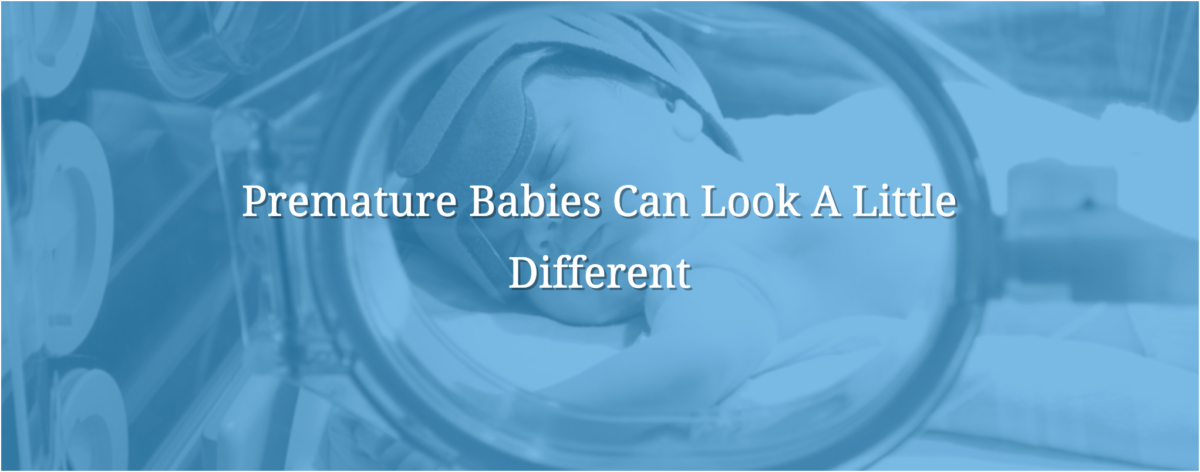 What Preterm Babies Look Like – INFANT