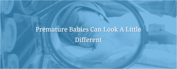 What Preterm Babies Look Like – INFANT